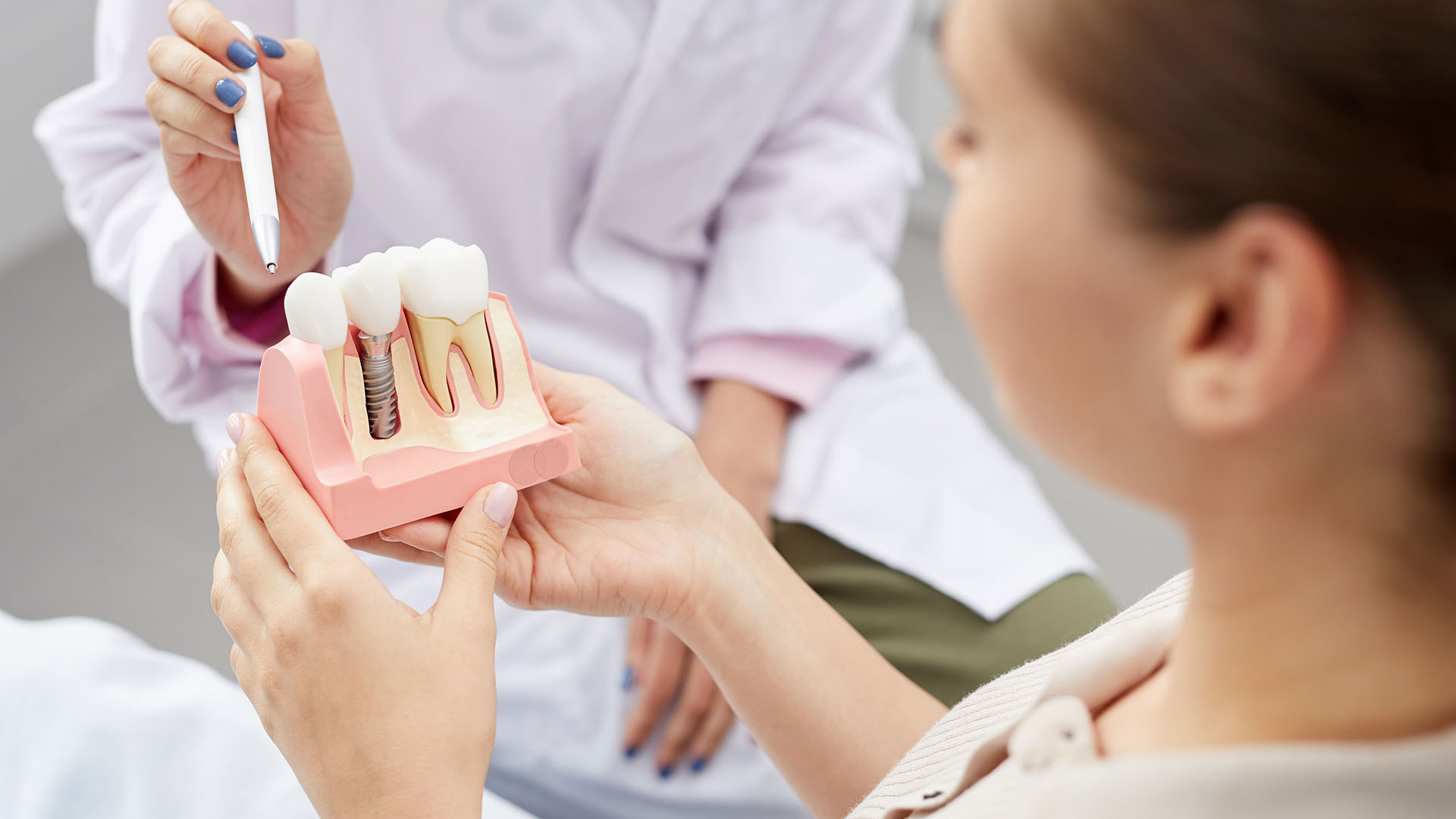 Implantate - Zahnarzt Podbi Hannover - kenDent Dr. Kendra & Kollegen